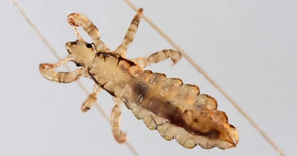 True facts and practical information about head lice and nits