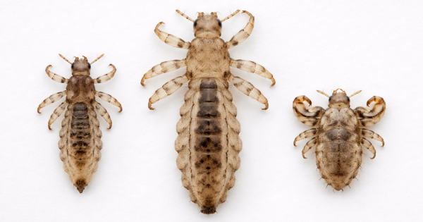 The difference between the three types of lice, how to treat and ...